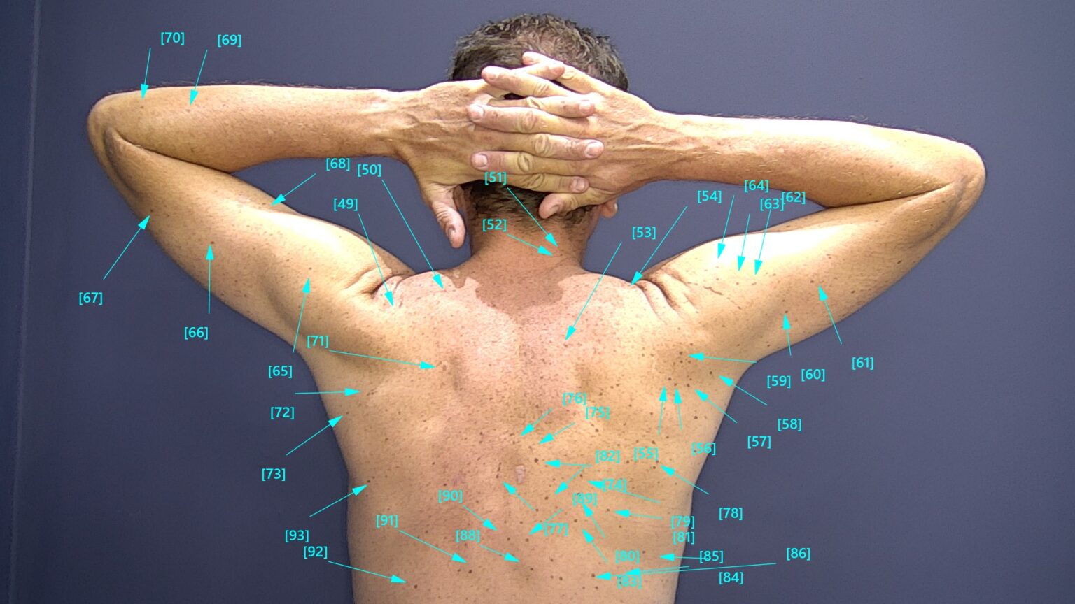 Mapeamento Corporal | Dr. Gustavo Bedin